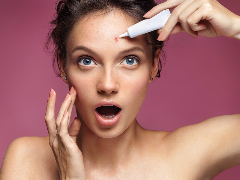Acne Complementary Medicine 101 The Best Guide To Treating Acne The Acne Complementary Medicine 101 The Best Guide To Treating Acne The